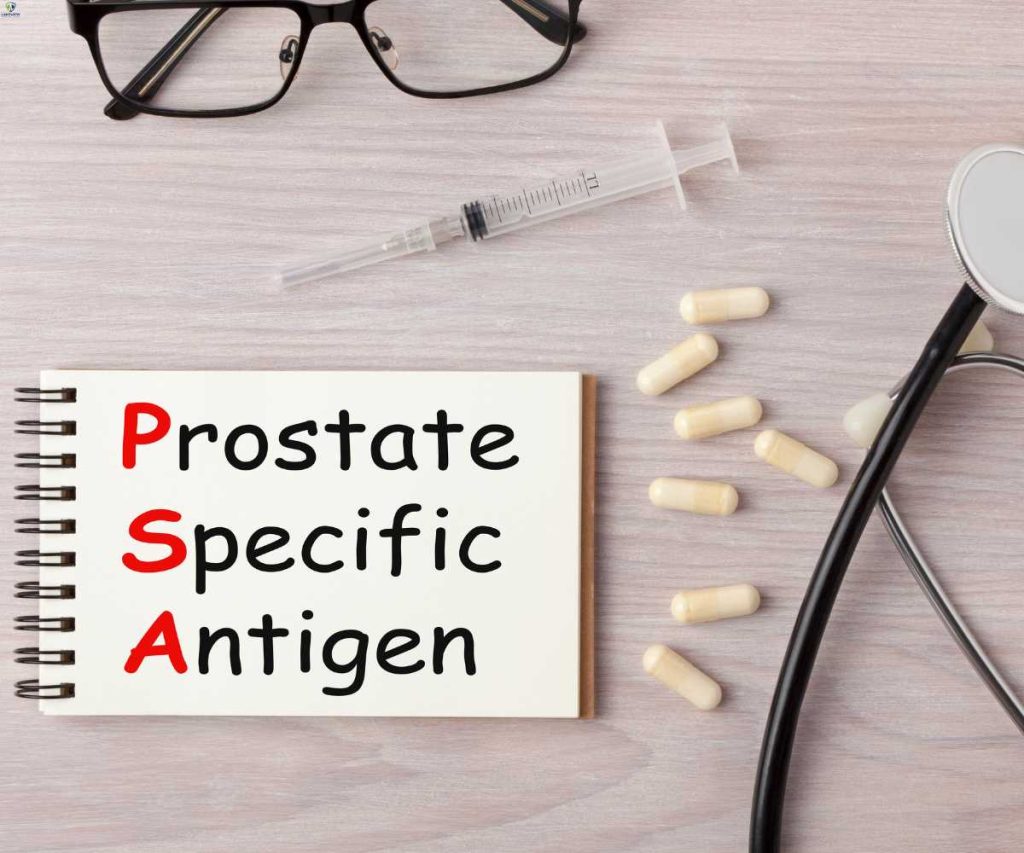 Elevated PSA – Lakeview Center for Urology